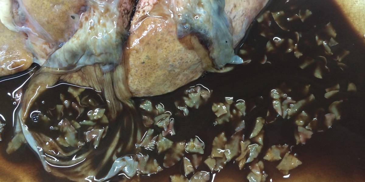 Liver Fluke | Diseases & Solutions | Farm Health First