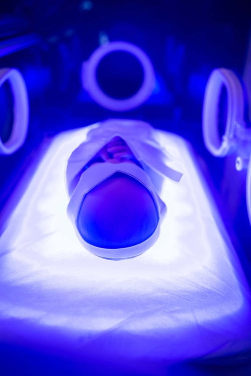 Skylife Neonatal Phototherapy System