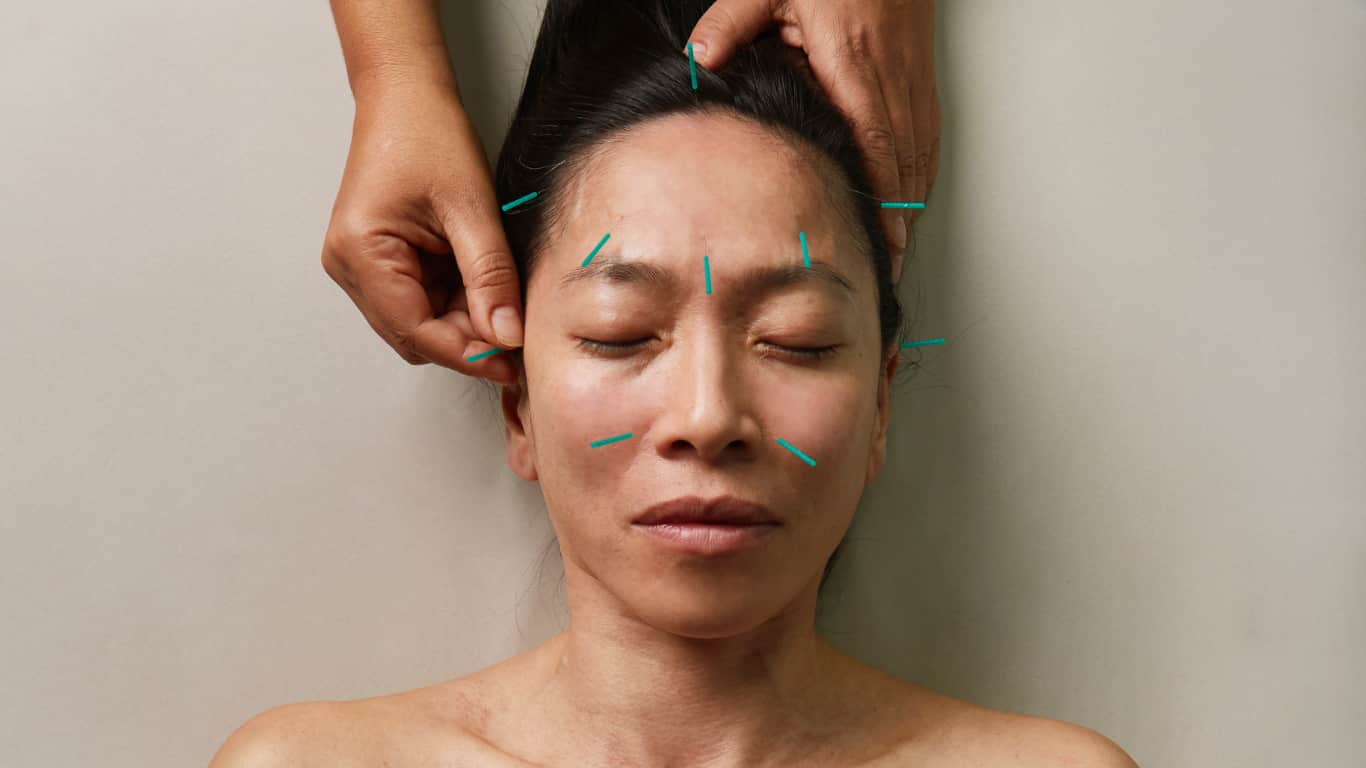 Introducing Acu-Facial Rejuvenation | Olo Acupuncture