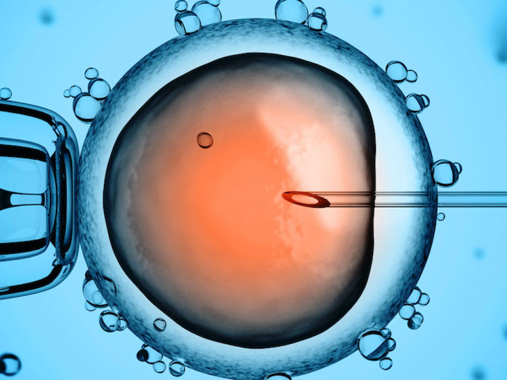 Episode 453 - The History of IVF | English Learning for Curious Minds