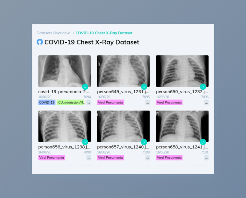 20+ Best Image Datasets for Computer Vision [2022]