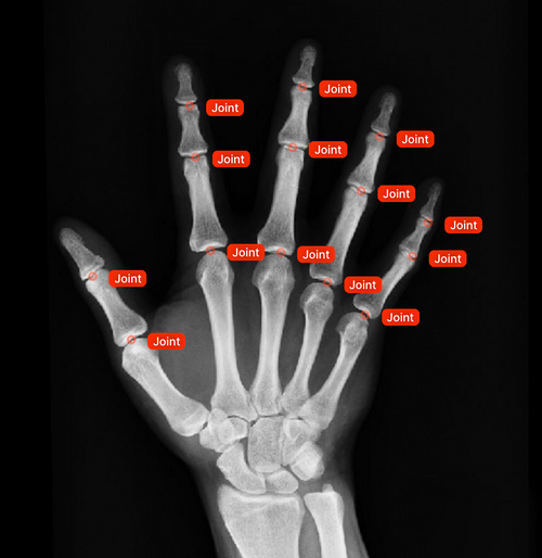 The Ultimate Guide to Medical Image Annotation