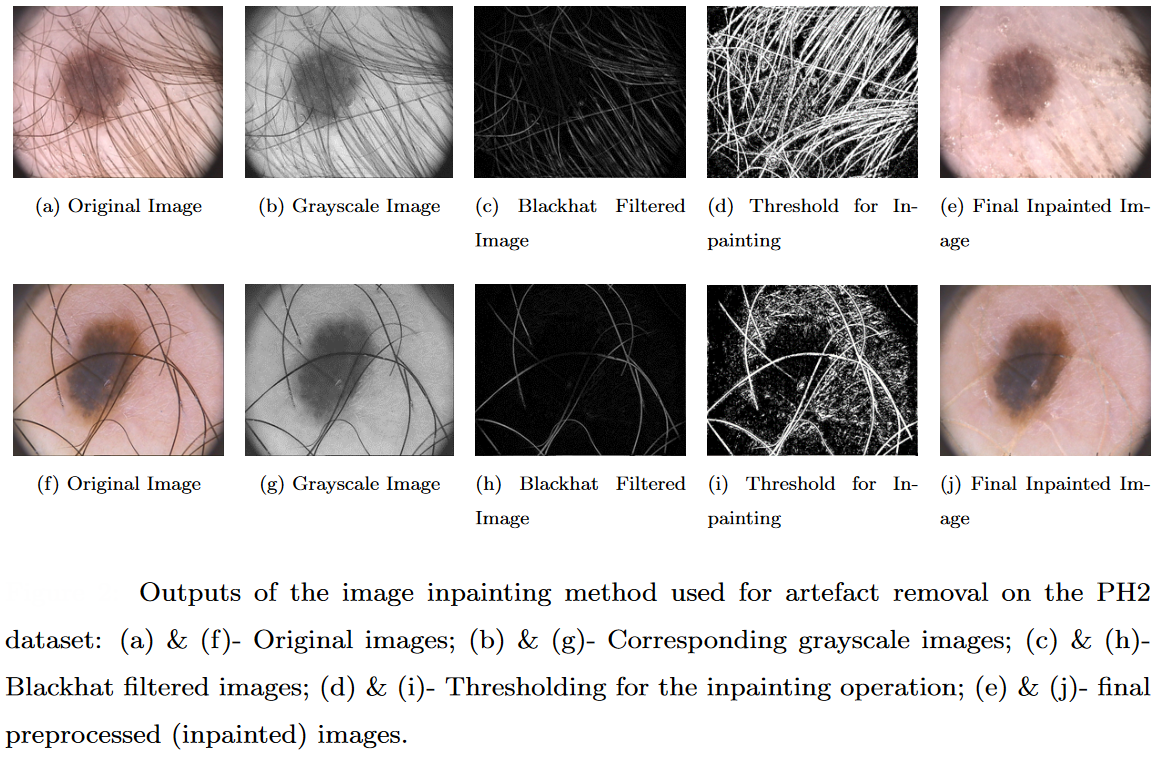 Image Processing Techniques Types Applications 2023 
