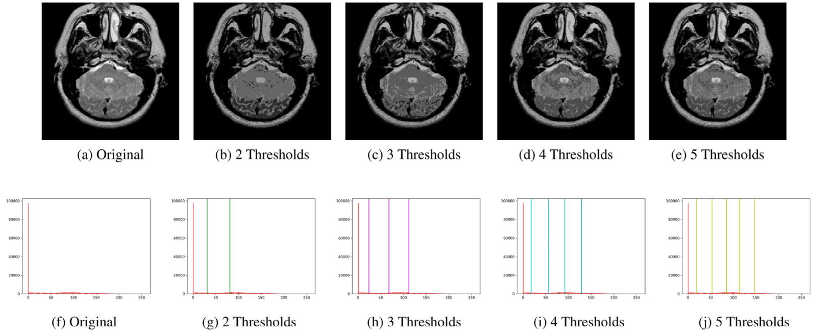 Image Processing: Techniques, Types, & Applications [2023]