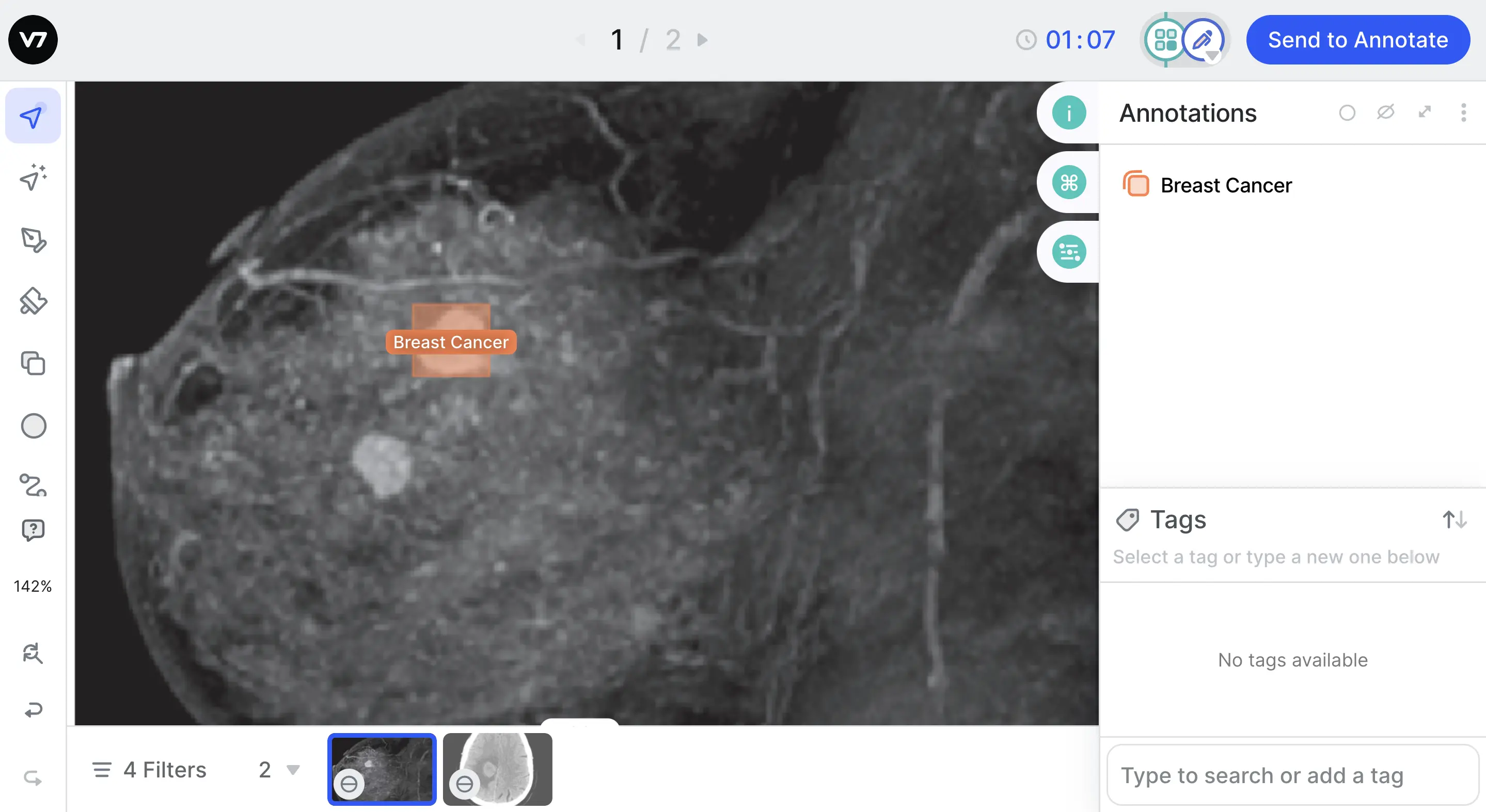 AI in Radiology: Pros & Cons, Applications, and 4 Examples
