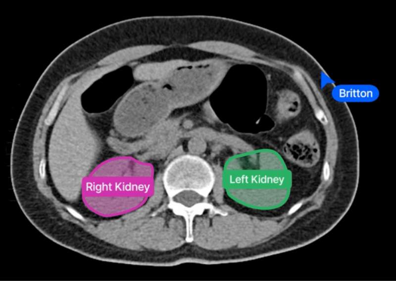 F1 Score in Machine Learning: Intro & Calculation