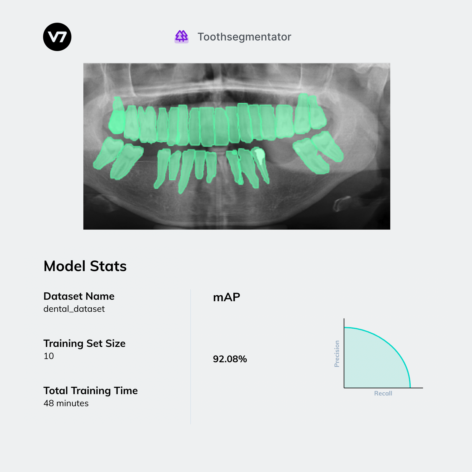 How to Annotate Radiology Data for Machine Learning on V7