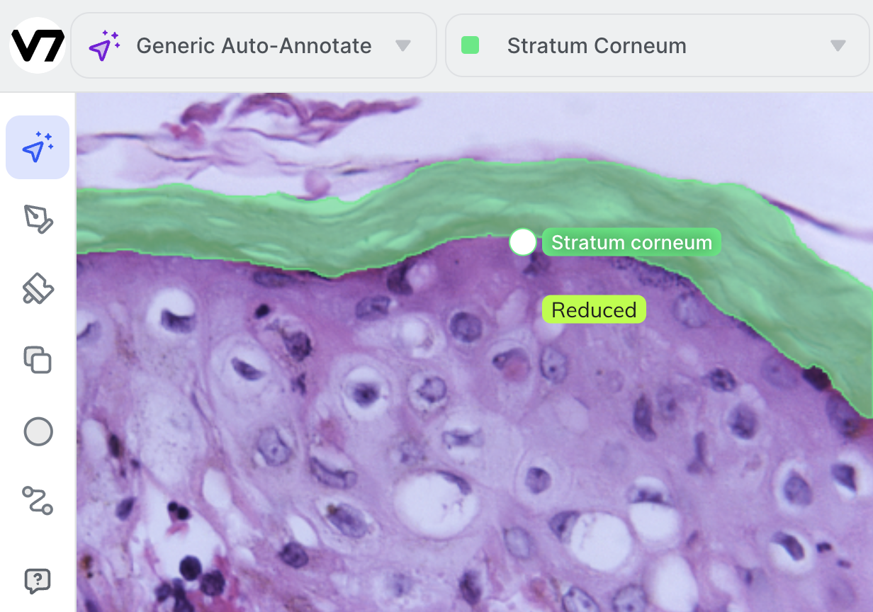 How to Annotate Digital Pathology Images for AI
