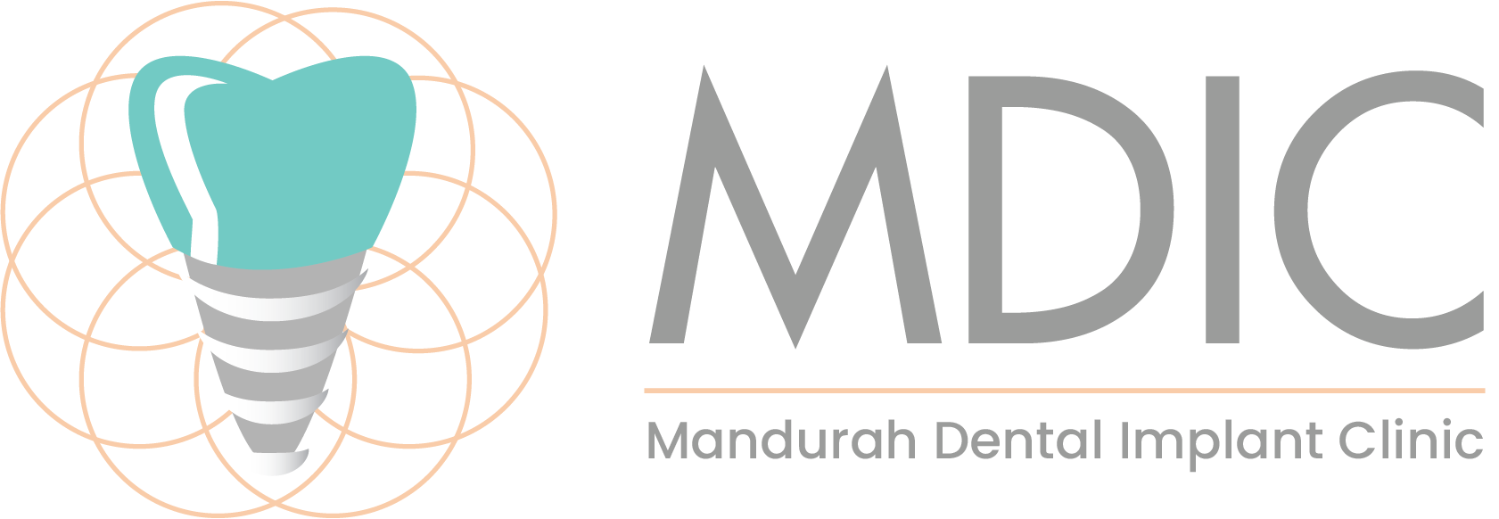 Mandurah Dental Implants | Mandurah Dental Implant Clinic