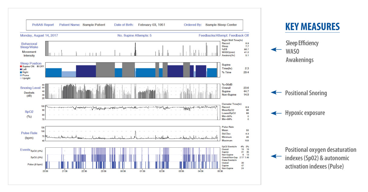 Positional Sleep Assessment System (PoSAS