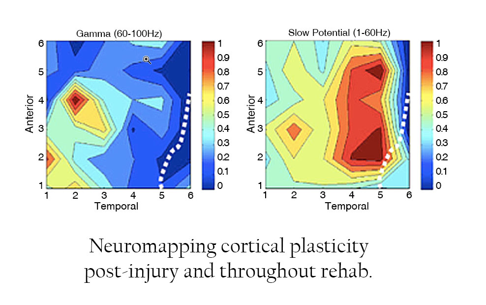 Brain Computer Interface (BCI)