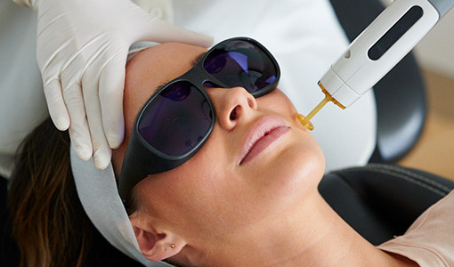 Vascular Laser Therapy & Treatment in Melbourne | Vic Dermal Group
