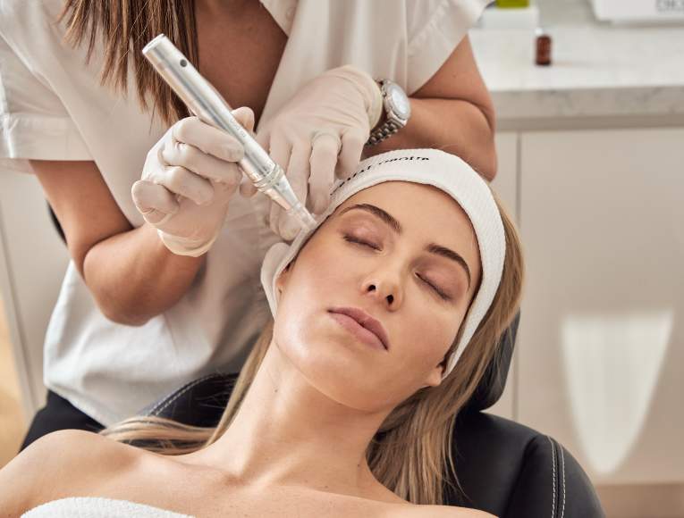 RF Needling | Victorian Dermal Group