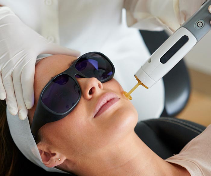 PicoWay Laser | Safe & Effective | Book Your Consultation Today