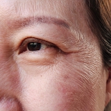 Loose And Sagging Skin Treatment | Skin Tightening Solutions