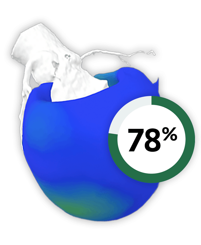 Myocardial Solutions | The MyoStrain® Test
