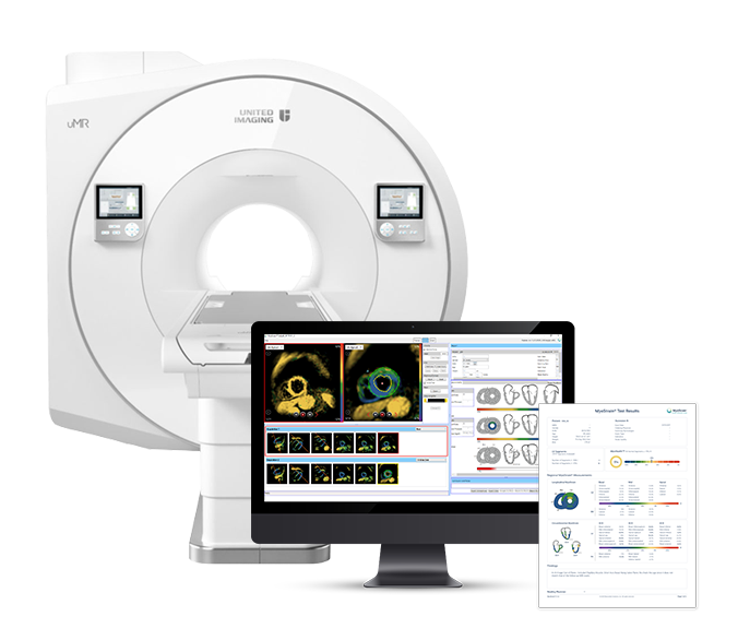 Myocardial Solutions | The MyoStrain® Test