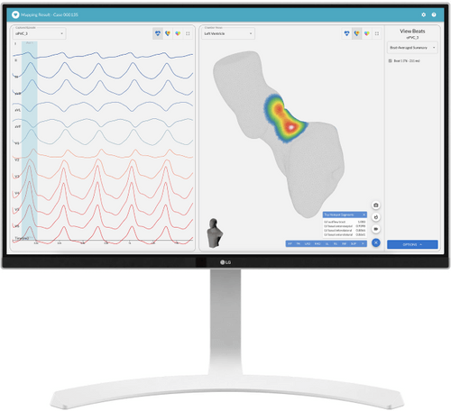 vMap | Vektor Medical