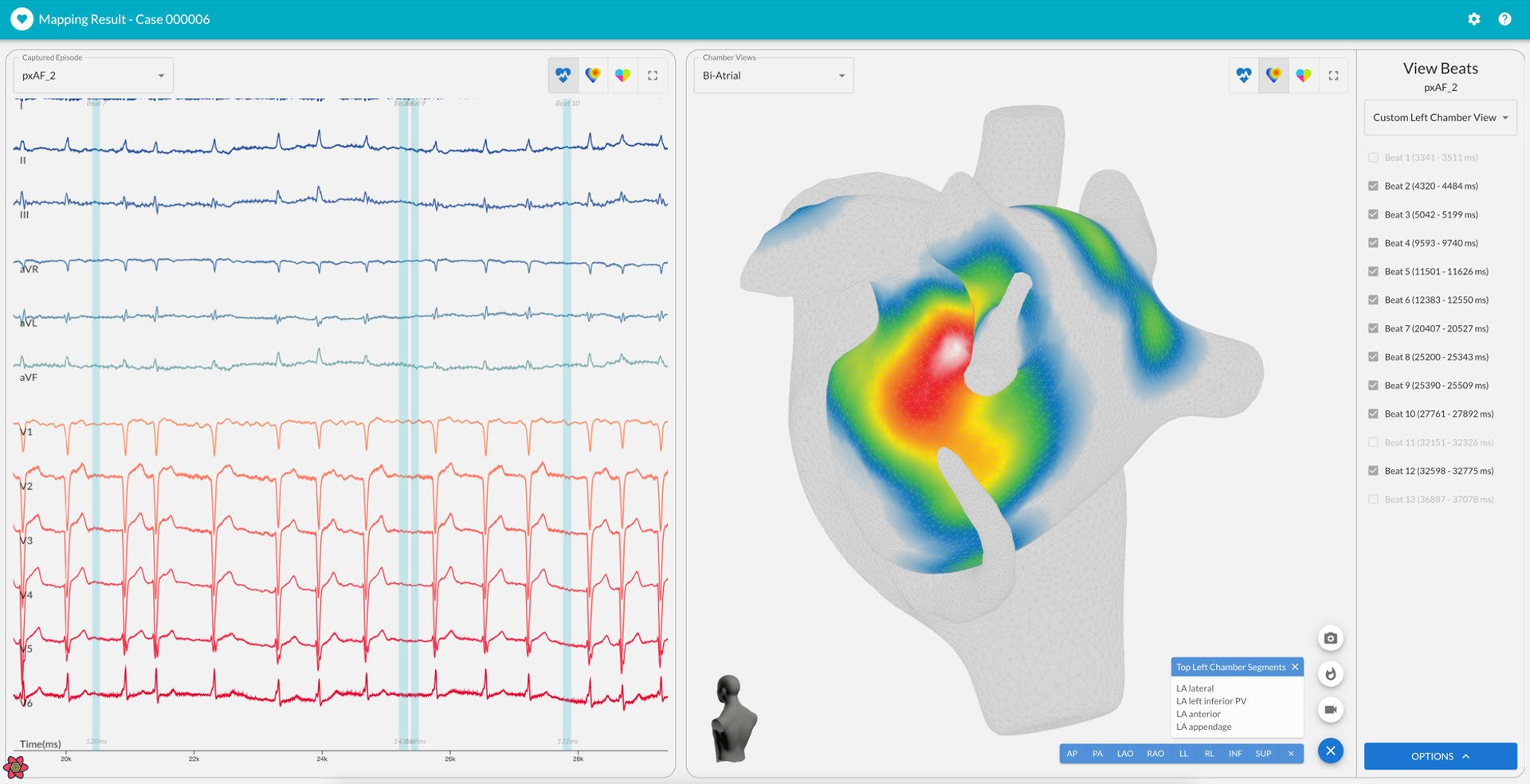 vMap | Vektor Medical