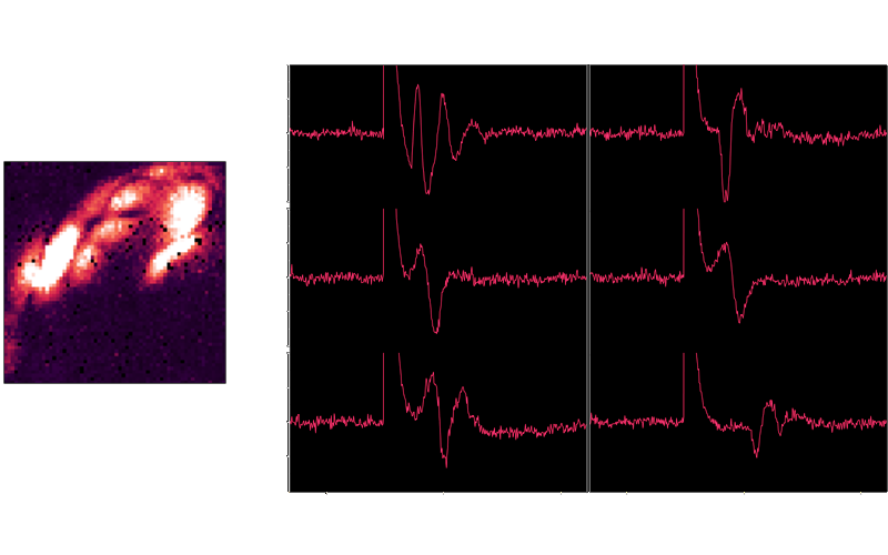 Brain Slices - 3Brain