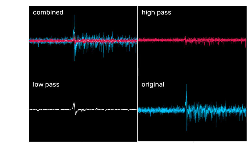 Brain Slices - 3Brain