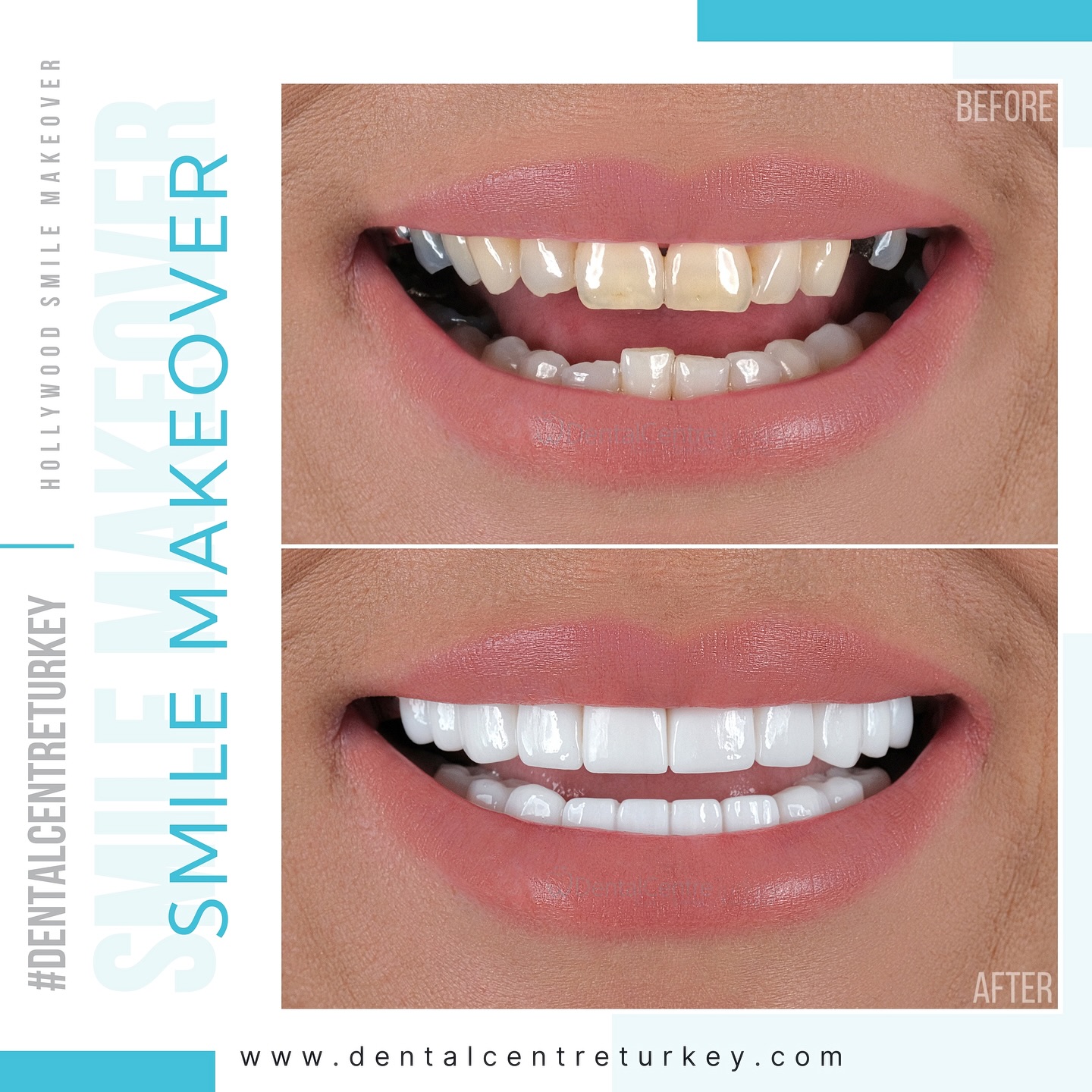 DENTAL CENTRE TURKEY UK - Kandoo