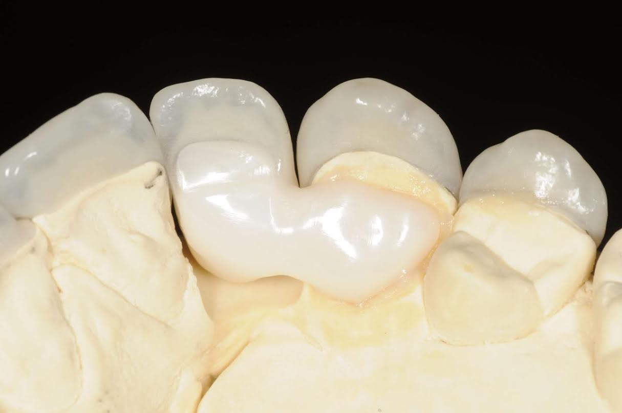 Services: Cleft Palate | Brisbane Prosthodontics