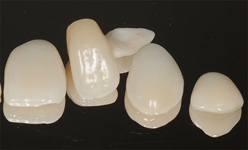 Services: Cleft Palate | Brisbane Prosthodontics