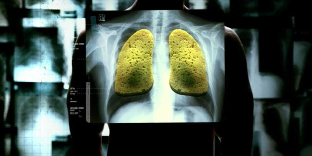 Our anti-smoking campaigns | Make Smoking History