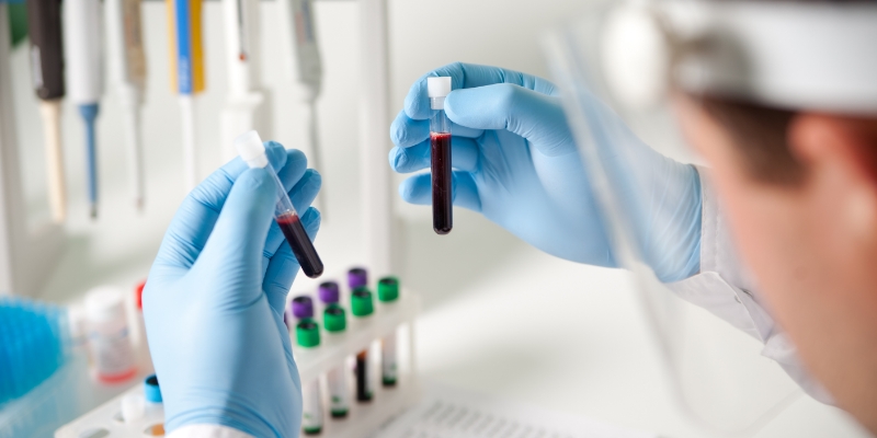 Hematology - Branch of Medicine