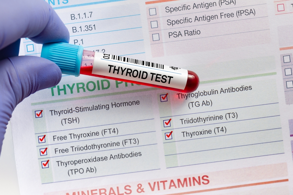 What Are Thyroid Antibodies?