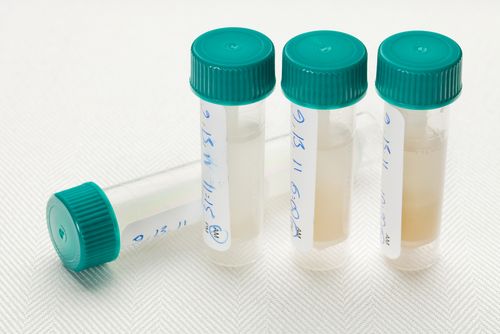 Saliva Testing: Cortisol and Hormone Test Result Interpretation Guide