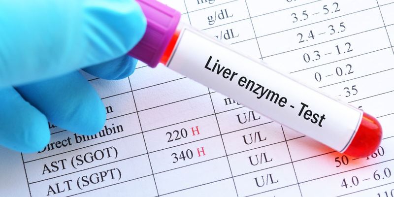 Interpreting Liver Enzyme Tests: ALT, AST, and ALP in Liver Health ...