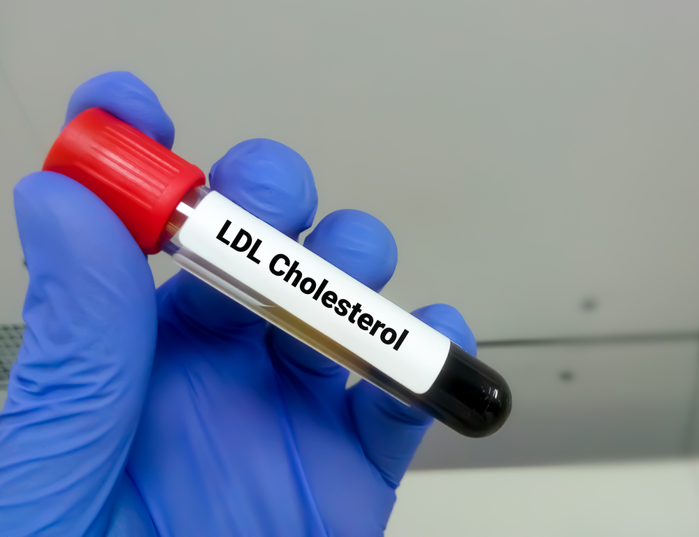 How to Lower LDL Cholesterol Naturally: Evidence-Based Recommendations