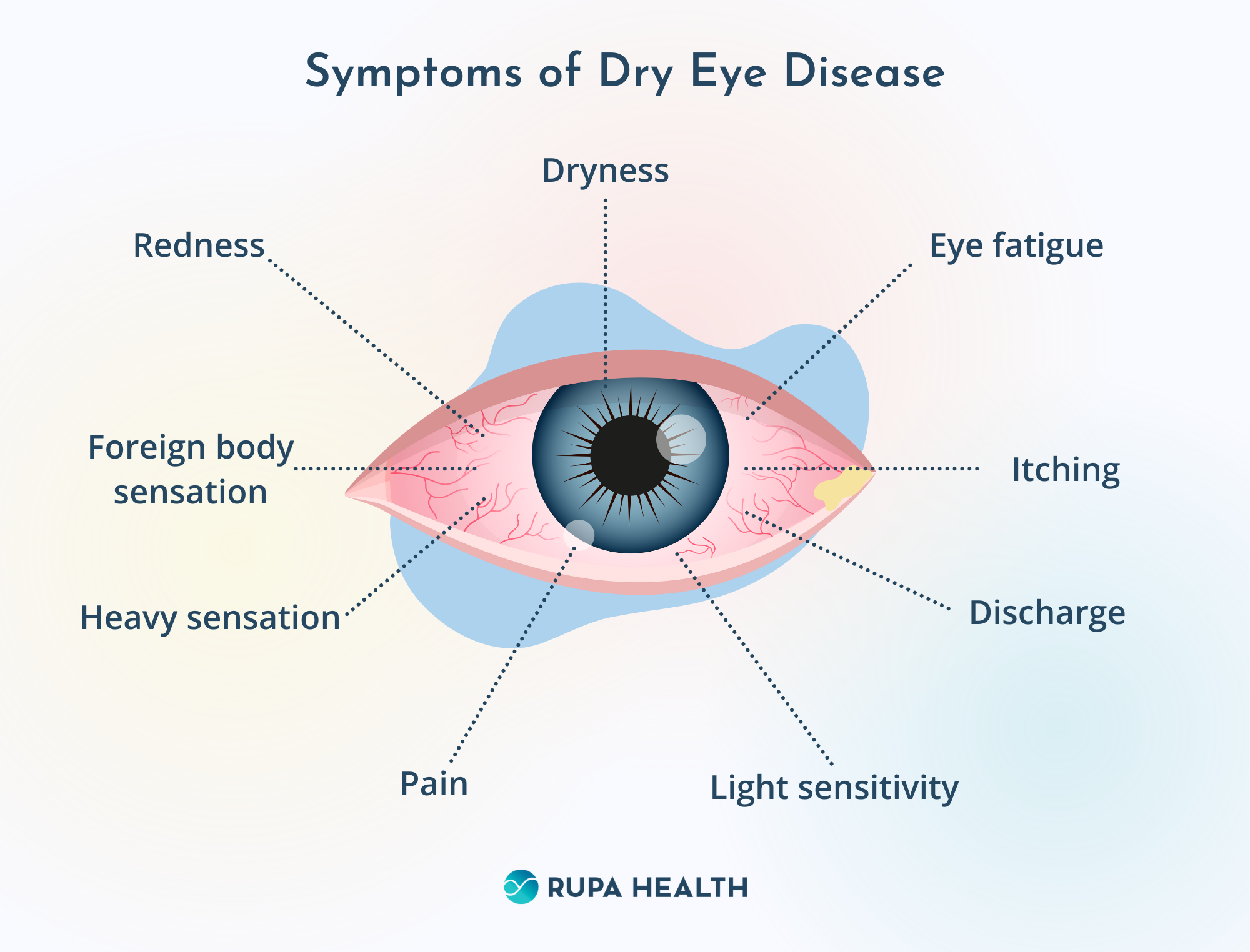 Gut Health and Its Connection to Dry Eye Disease