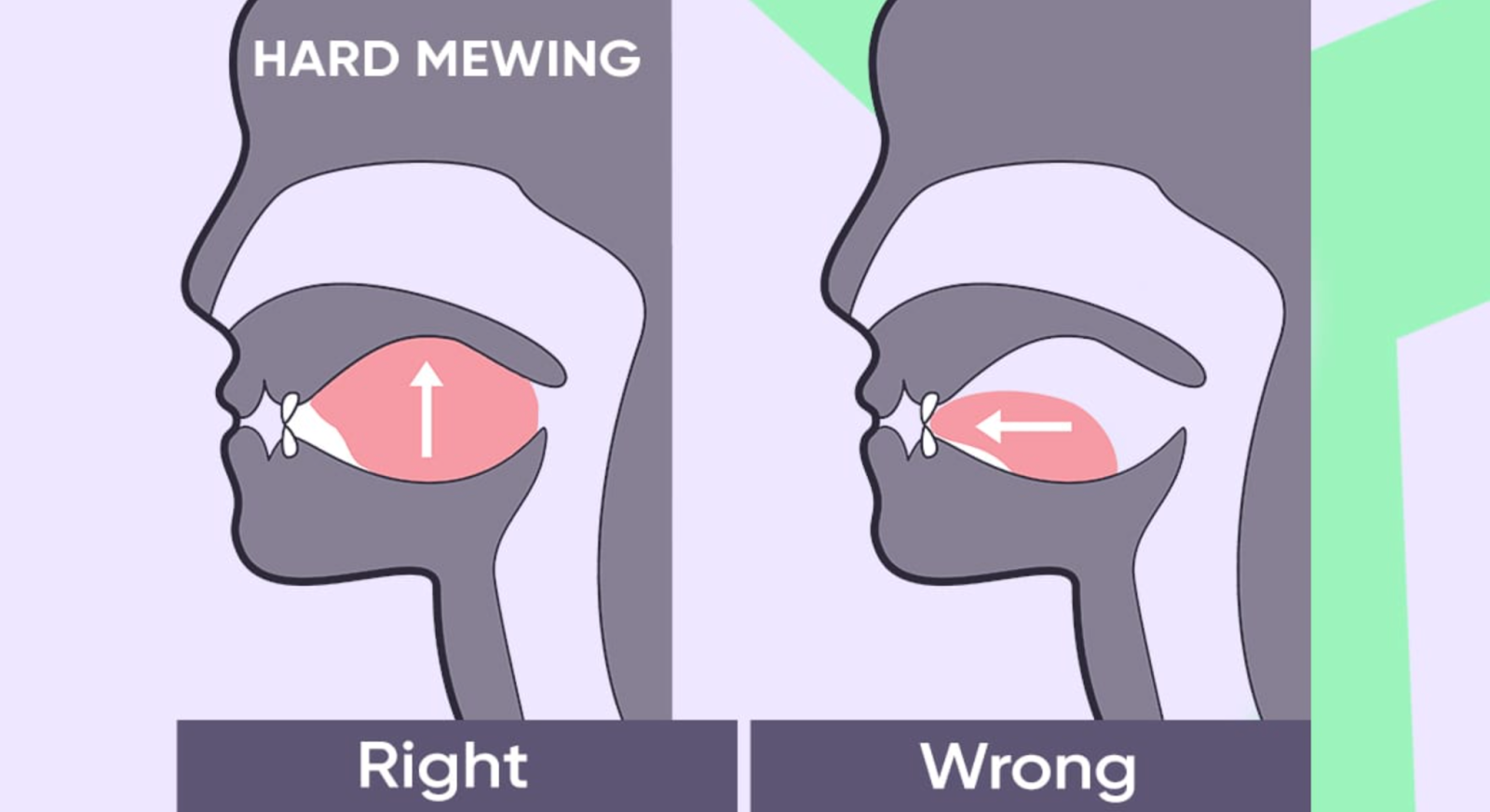 What is Mewing, and Does it Work?
