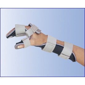 Resting Hand Orthosis | RCAI | Orthotic Bracing