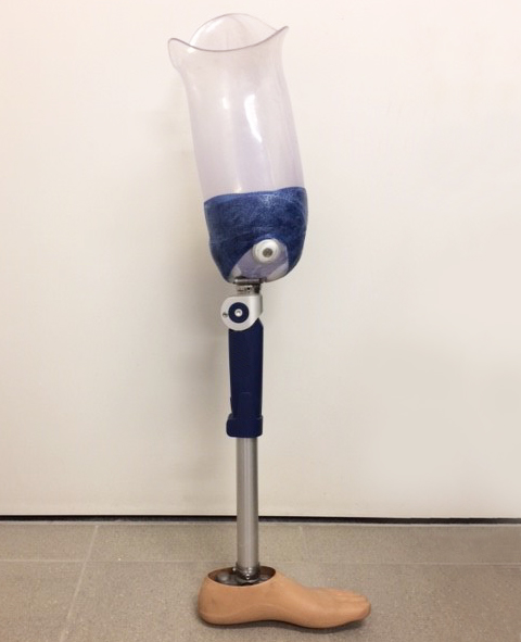 Advantages of Using a Thermoplastic Check Socket