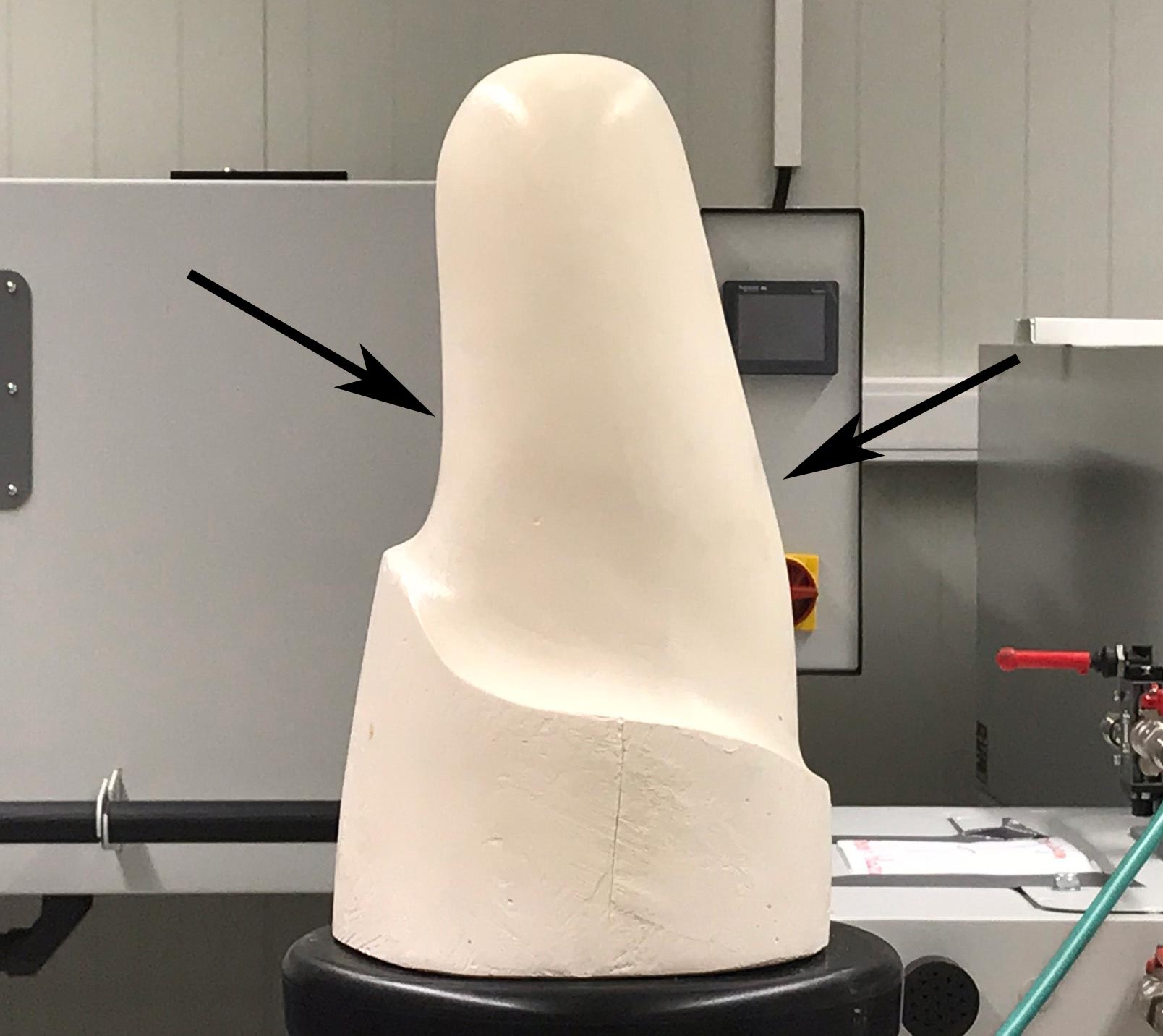 The Art of Moulding a Prosthetic Socket