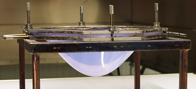 The Art of Moulding a Prosthetic Socket