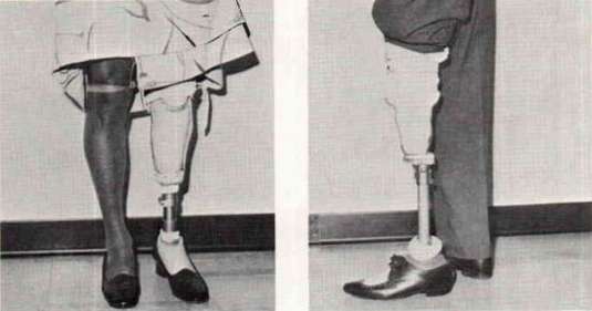 The History of the Check Socket