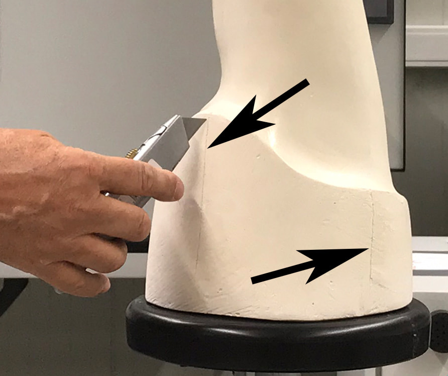 The Perfect Positive Mould for Prosthetics