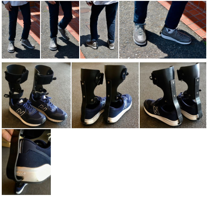 RQ Carbon AFO Strut | Human IQ | Orthotic Components