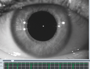 Diagnostic – Specular Microscope: REM 4000