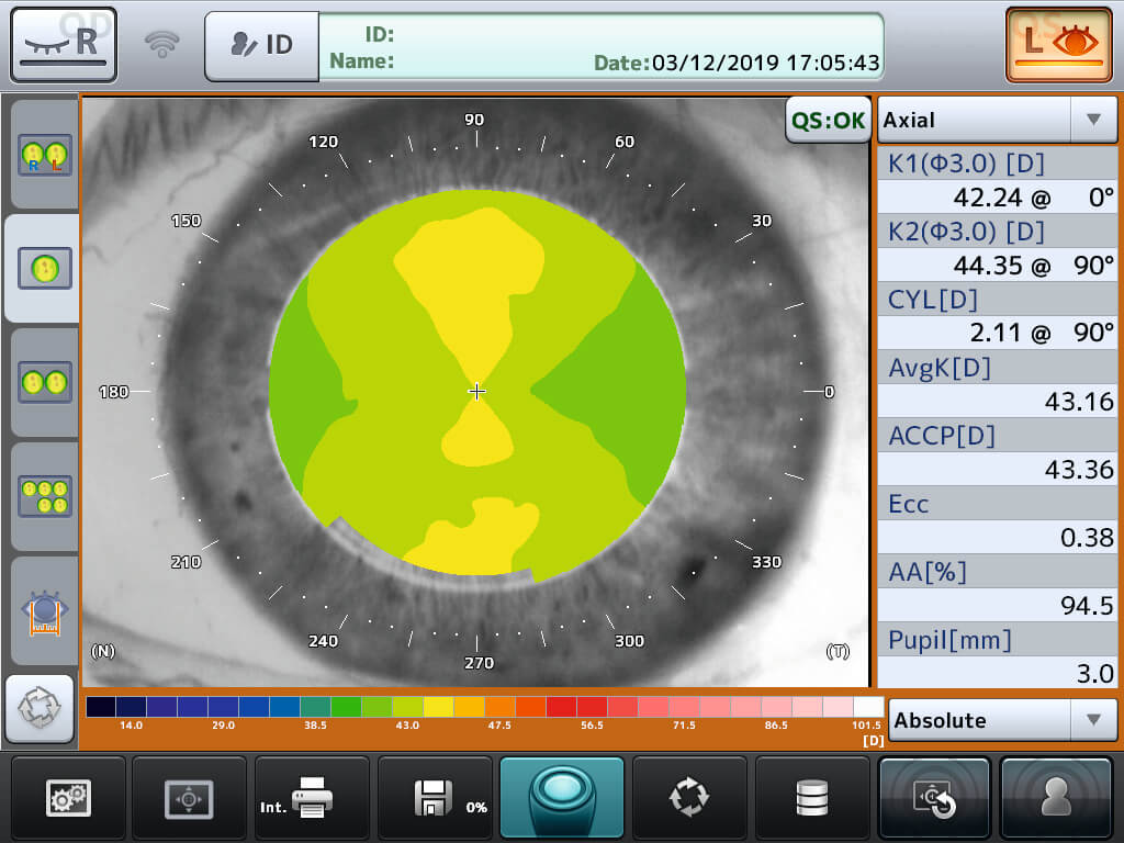 Diagnostic – Specular Microscope: REM 4000