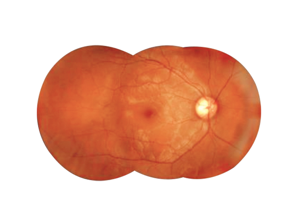 Diagnostic – Specular Microscope: REM 4000