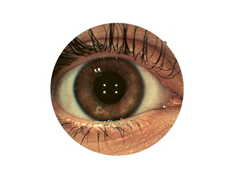 Diagnostic – Specular Microscope: REM 4000