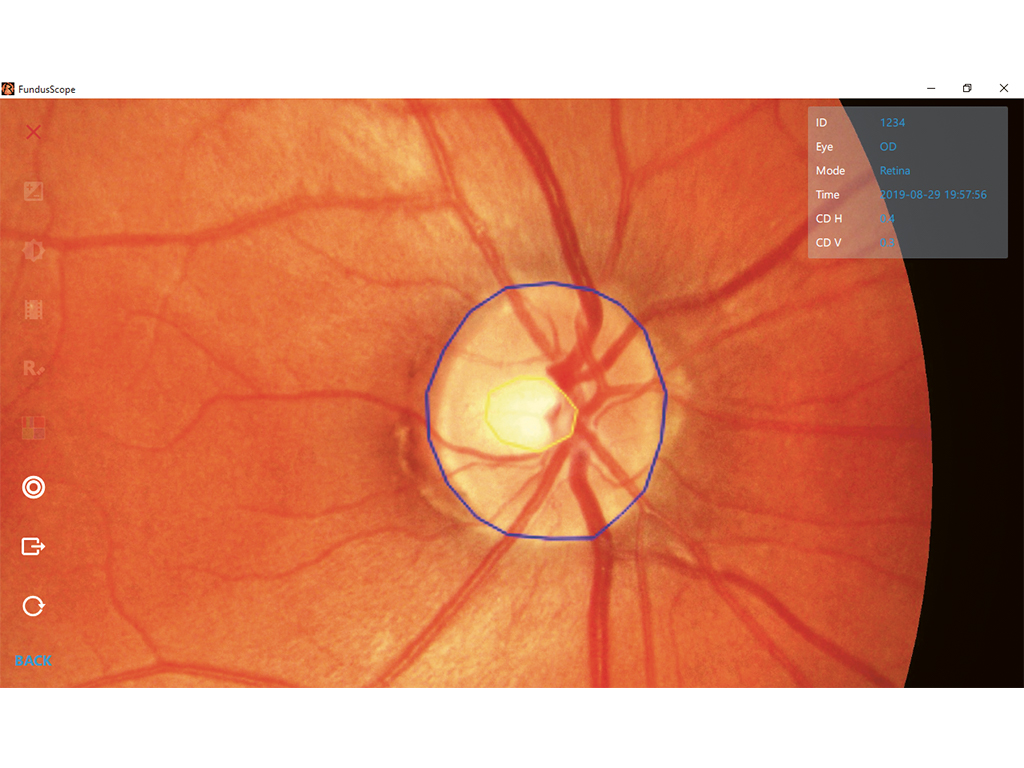 Diagnostic – Specular Microscope: REM 4000