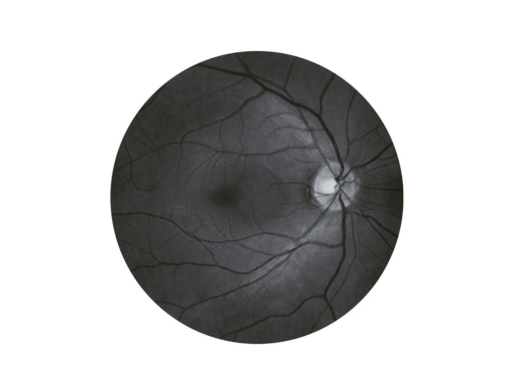 Diagnostic – Specular Microscope: REM 4000