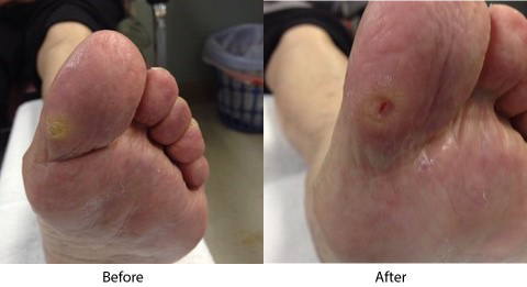 Services - Feet First Foot Care | Routine and Diabetic Nursing Foot Care